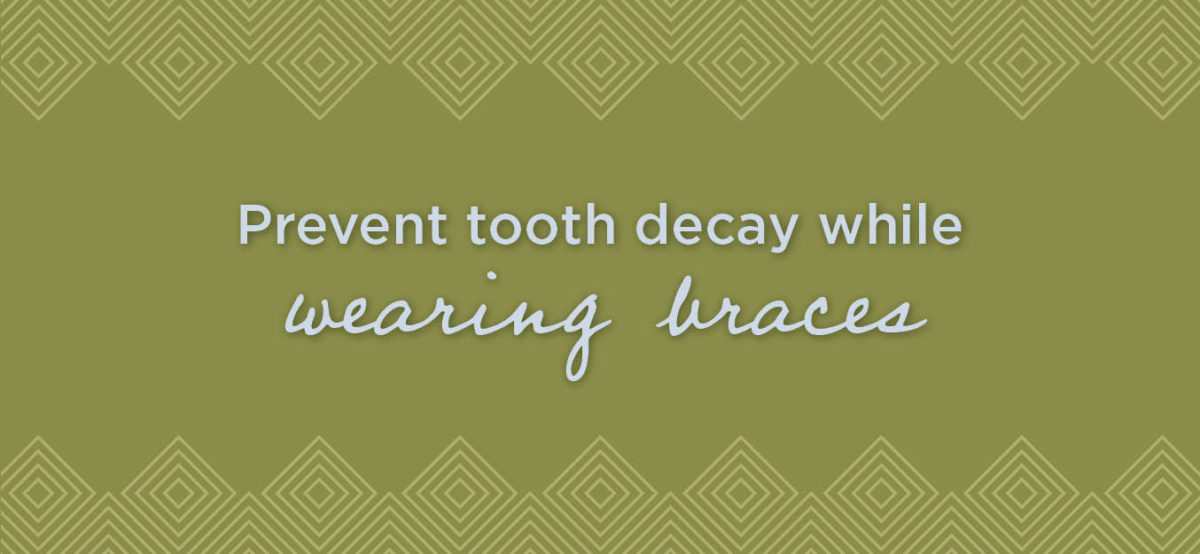 Tooth Decay Prevention: Brushing with Braces | Jay Harris Orthodontics