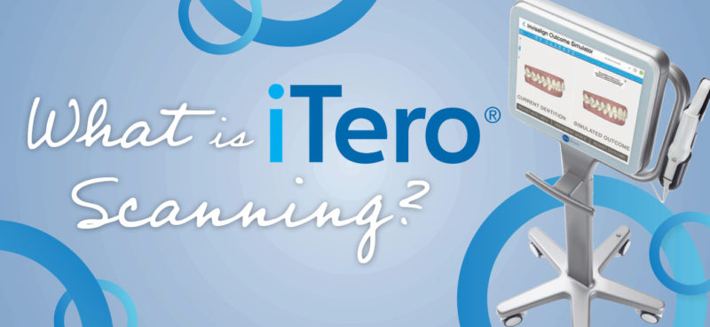 What is iTero® Scanning? - Jay Harris Orthodontics